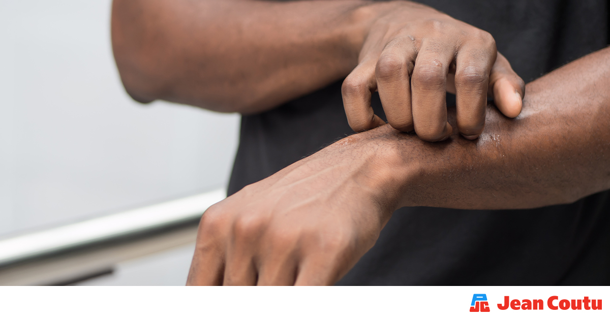 La démangeaison de la peau : un symptôme aux multiples causes | Jean Coutu