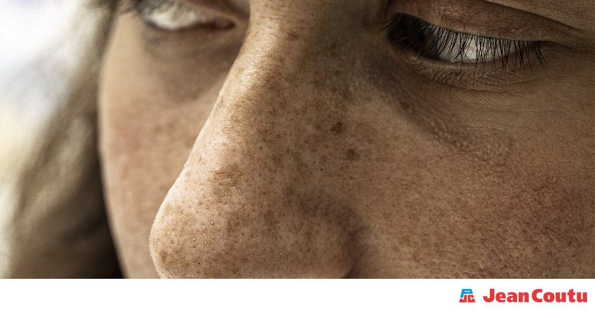 Dire adieu aux taches brunes | Jean Coutu