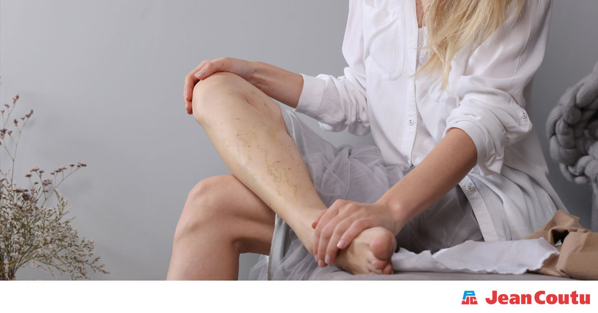 Comment prévenir et traiter les varices | Jean Coutu
